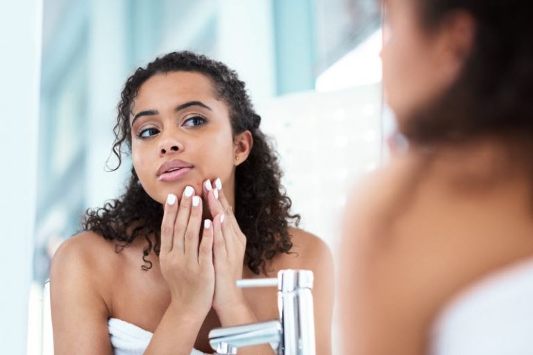 What is Cystic Acne? And How Should You Treat It? | Vitacost Blog